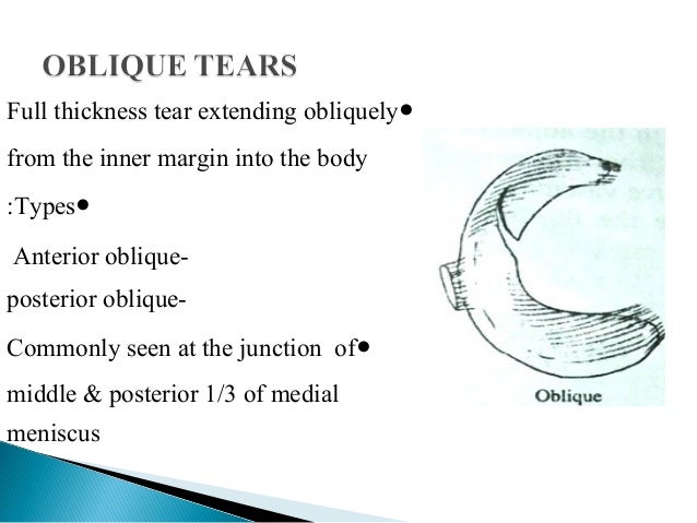 Reading Meniscus Line