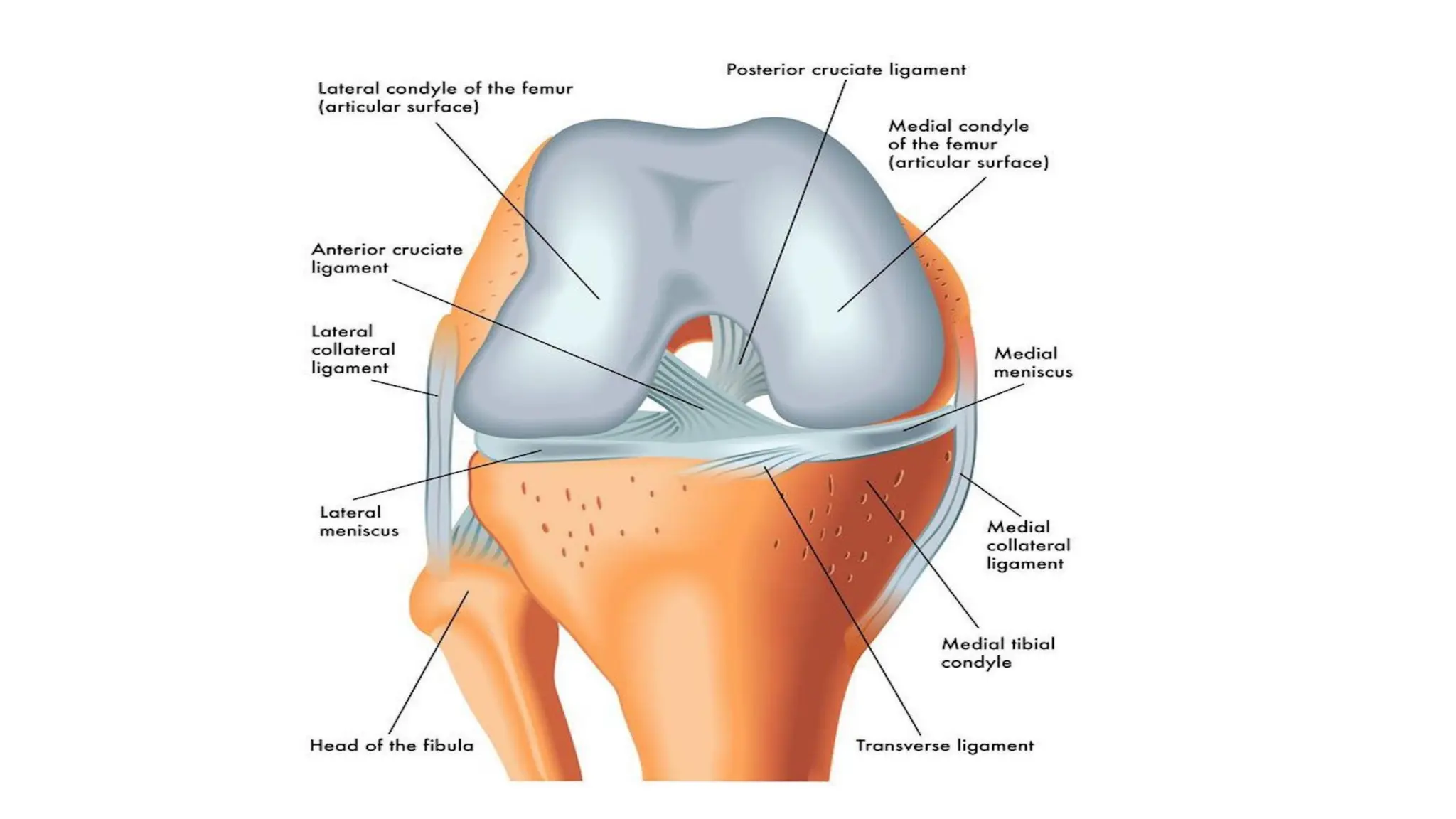 Meniscal injuries & Discoid meniscus (2024).pptx