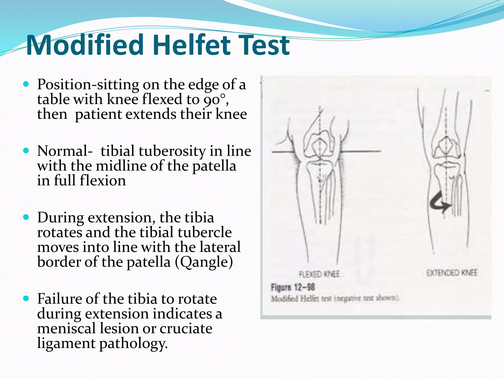 Meniscal injury | PPTX