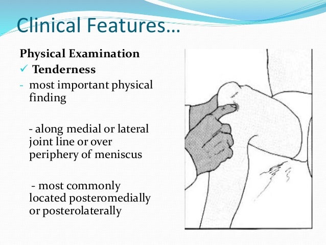 Meniscal injury