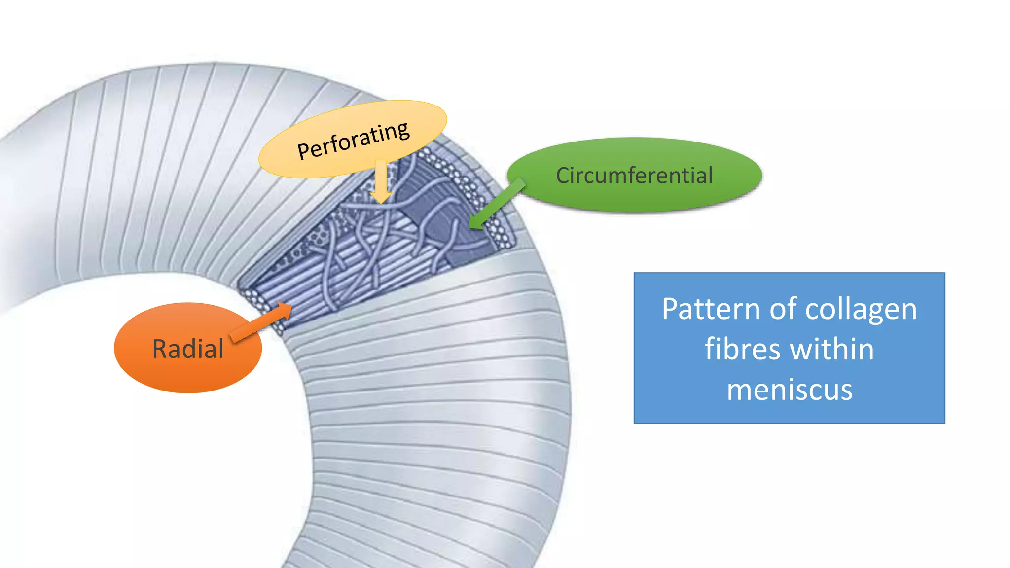 Meniscal injury | PPTX