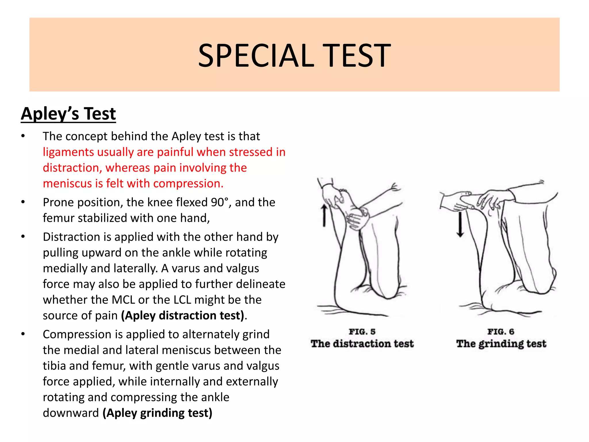 Meniscal injury | PPTX