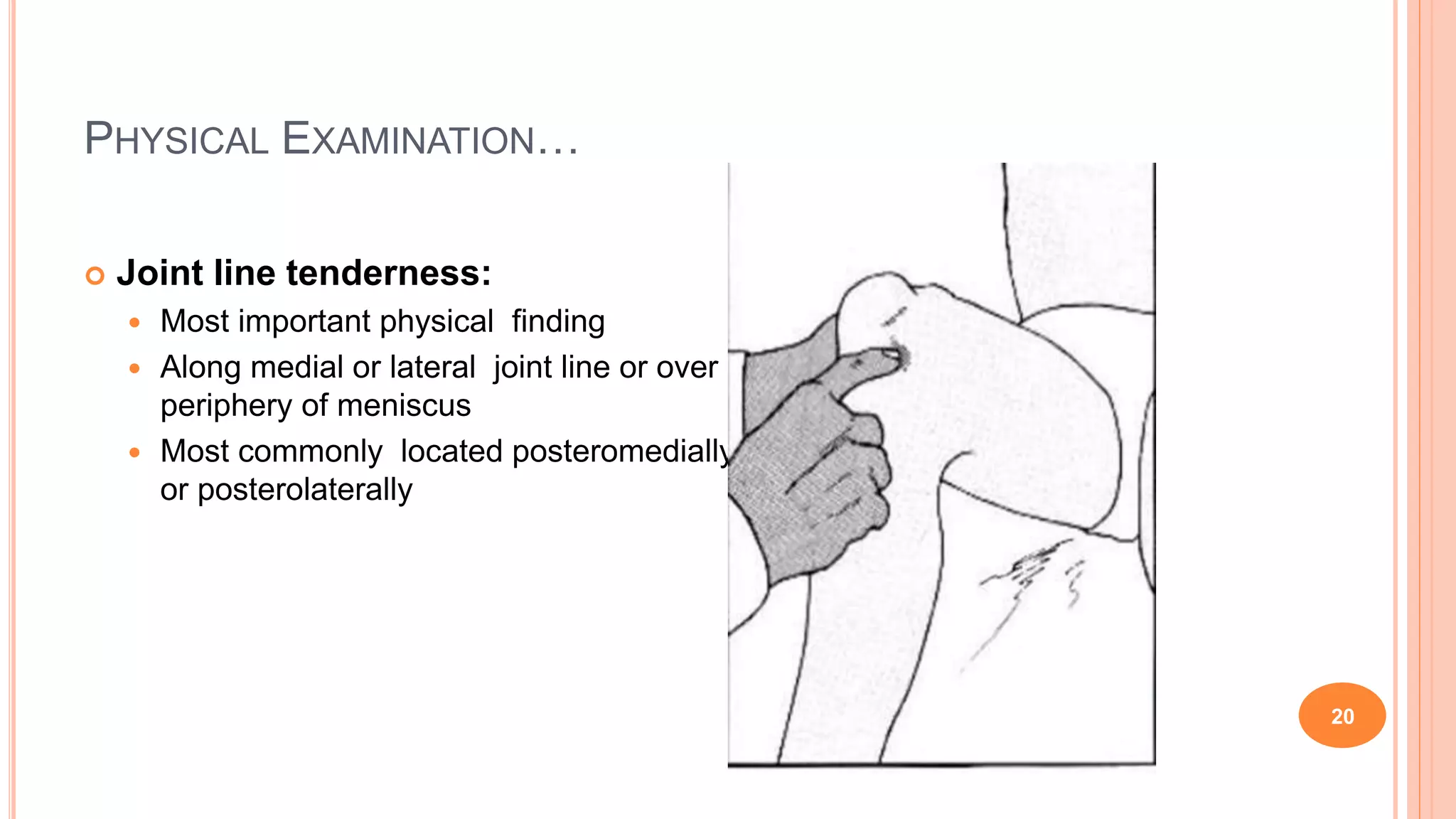 Meniscal injuries | PPTX