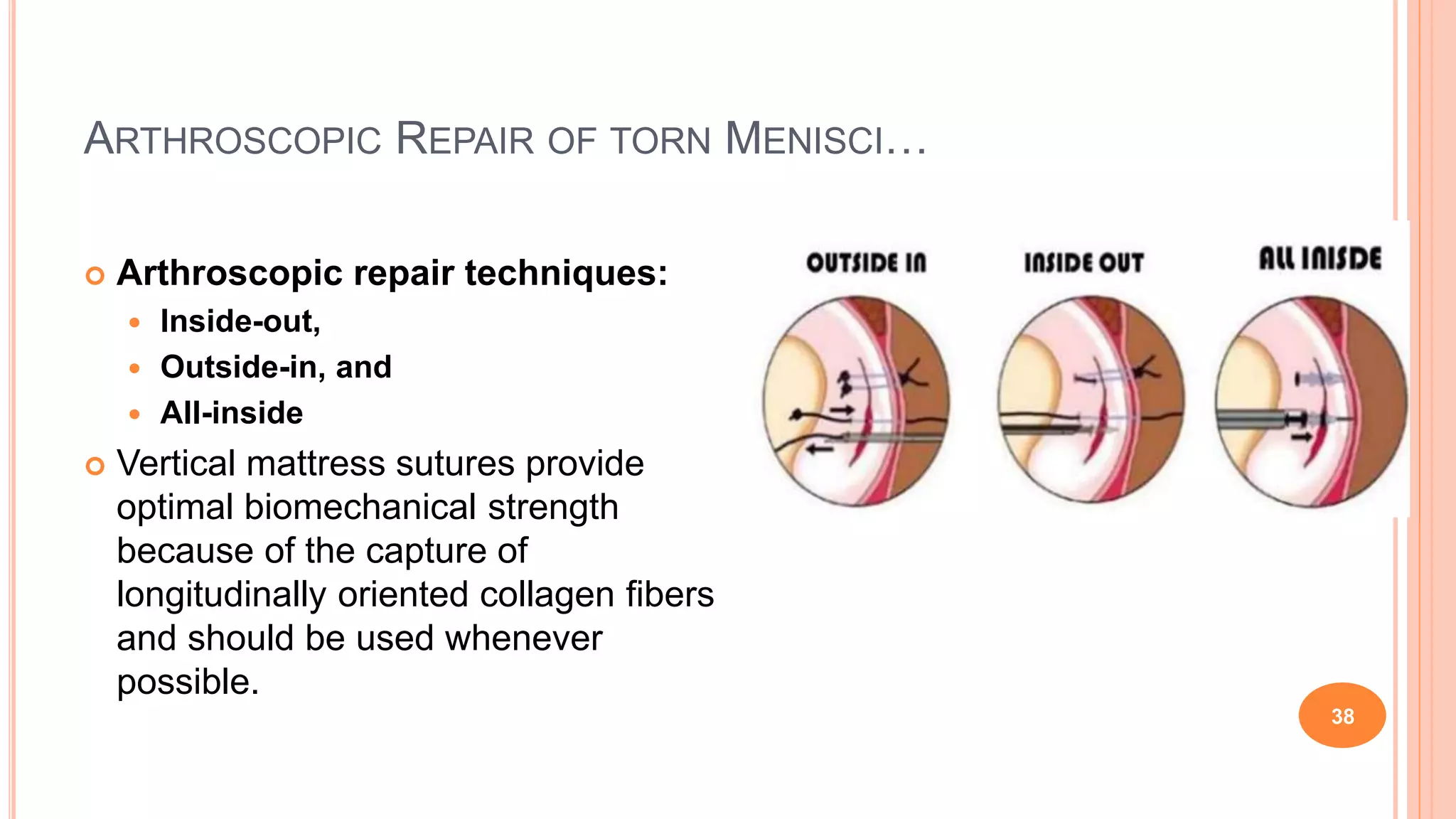 Meniscal injuries | PPTX