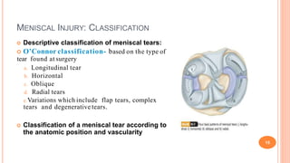Meniscal injuries | PPT