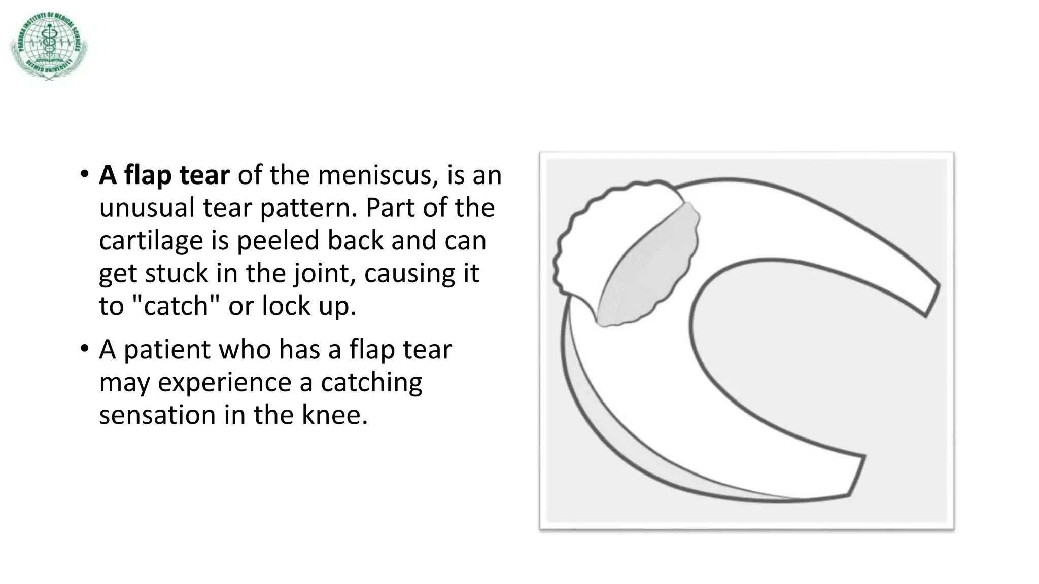 Meniscal injuries and physiotherapy management | PPTX