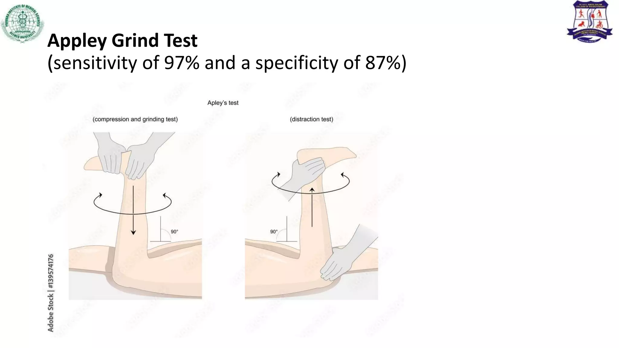 Meniscal injuries and physiotherapy management | PPTX