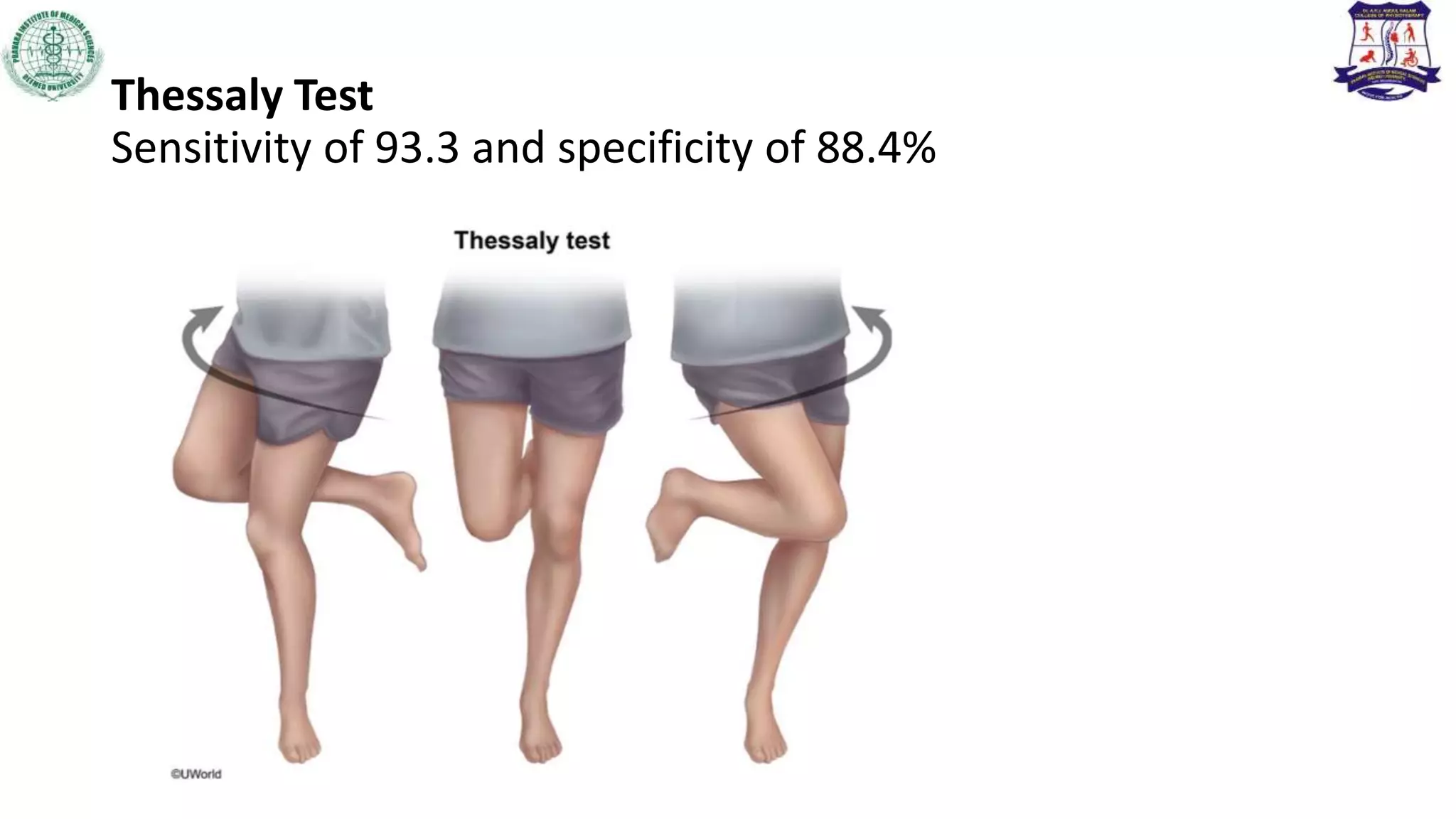 Meniscal injuries and physiotherapy management | PPTX