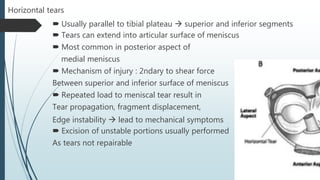 Meniscal injury | PPTX