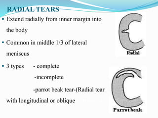 Meniscal pathologies and cartilage injuries | PPTX