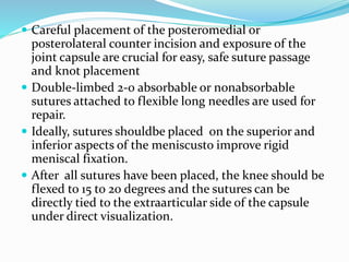 Meniscal pathologies and cartilage injuries | PPTX