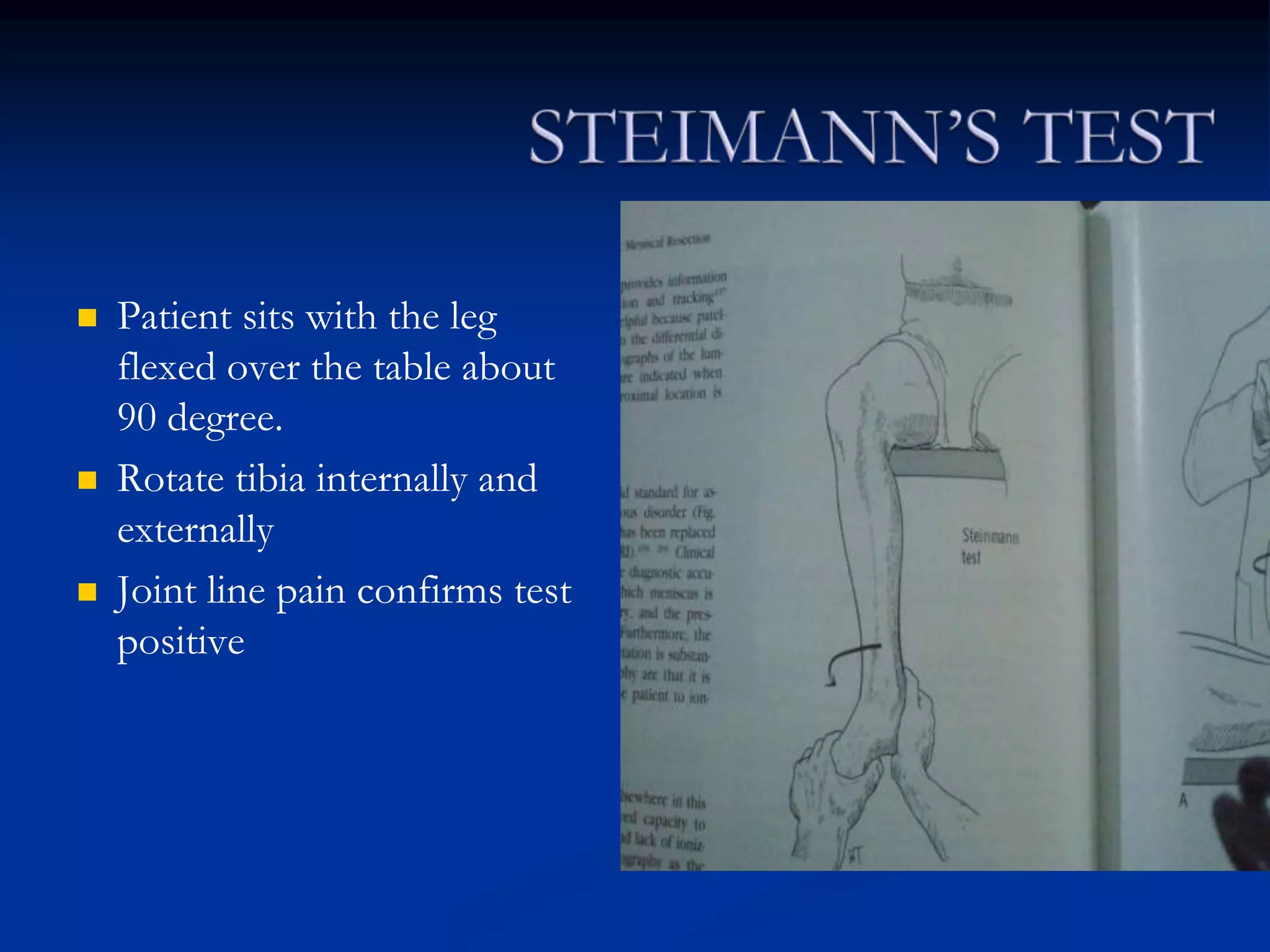 Meniscal pathology | PPT | Death, Injury, or Military Conflict ...