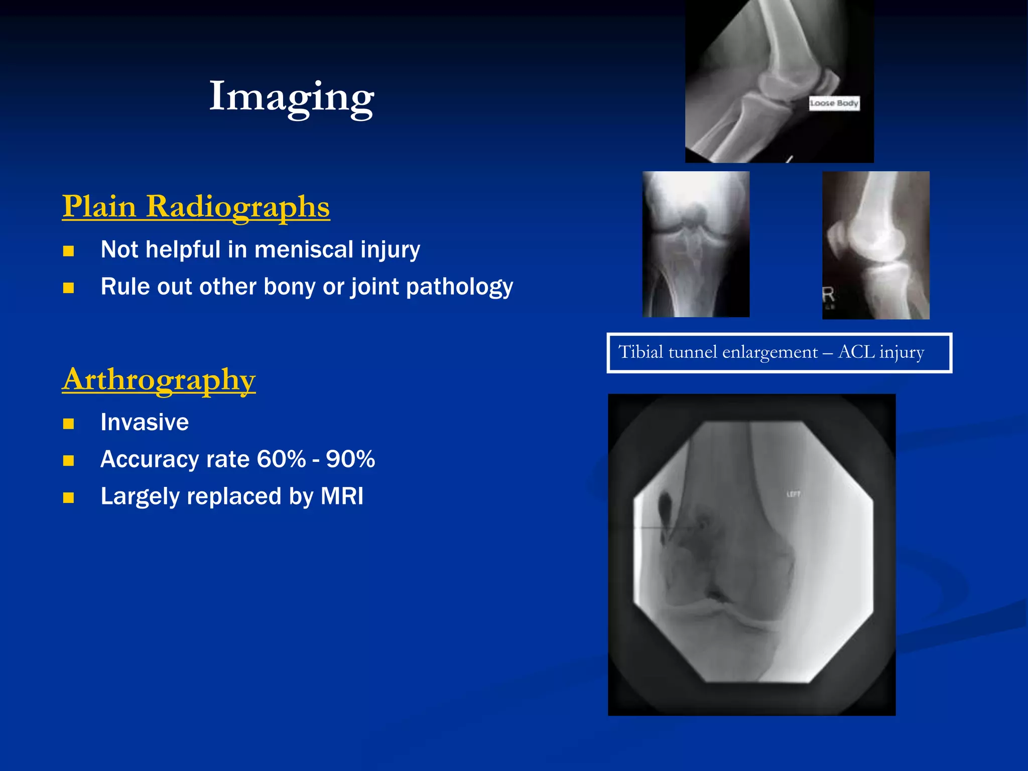 Meniscal pathology | PPT