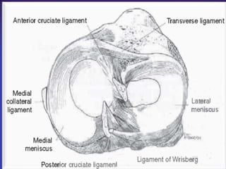 Meniscal pathology | PPT | Death, Injury, or Military Conflict ...