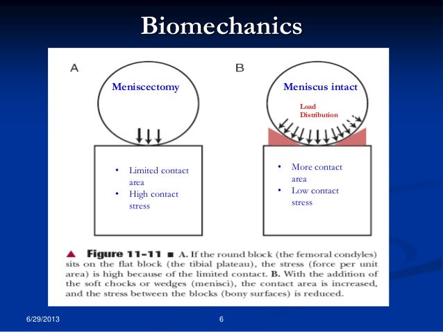 Meniscal pathology