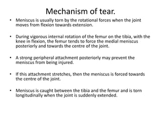 Meniscal tear | PPTX