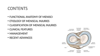 KNEE MENISCAL TEARS AND INJURIES TRATMENT.pptx