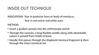 KNEE MENISCAL TEARS AND INJURIES TRATMENT.pptx