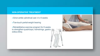 Meniscus injury | PPT
