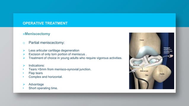 Meniscus injury | PPT