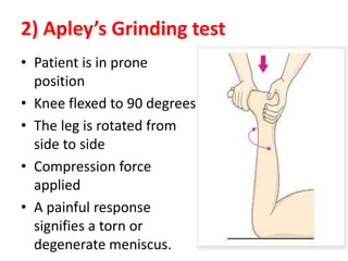 Meniscus injury | PPTX