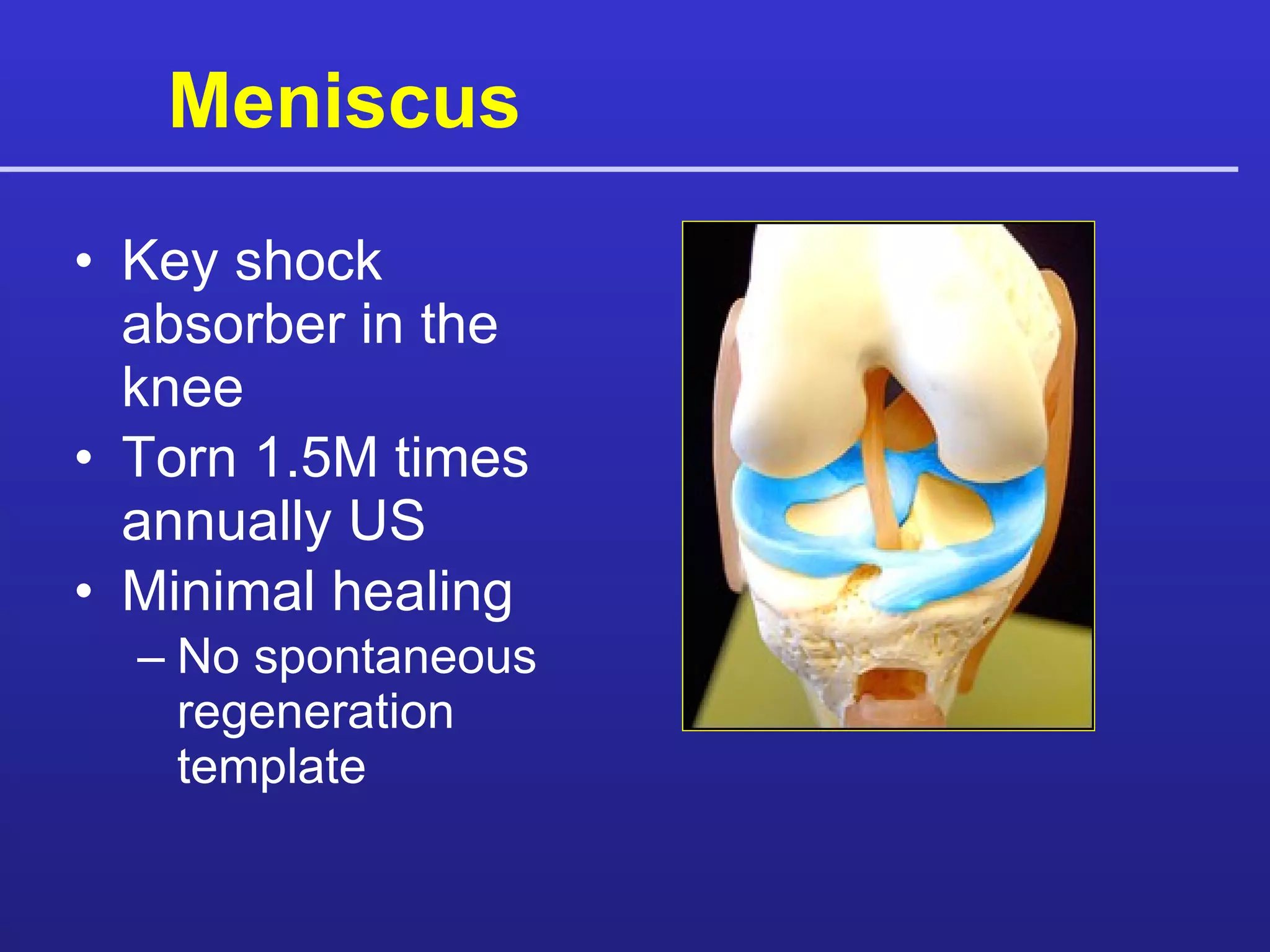 Meniscus Transplant and Replacement | PPT