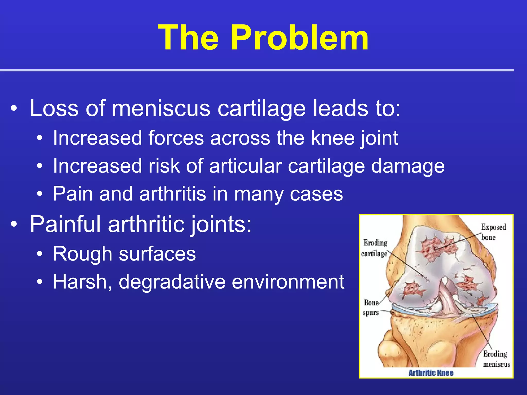 Meniscus Transplant and Replacement | PPT
