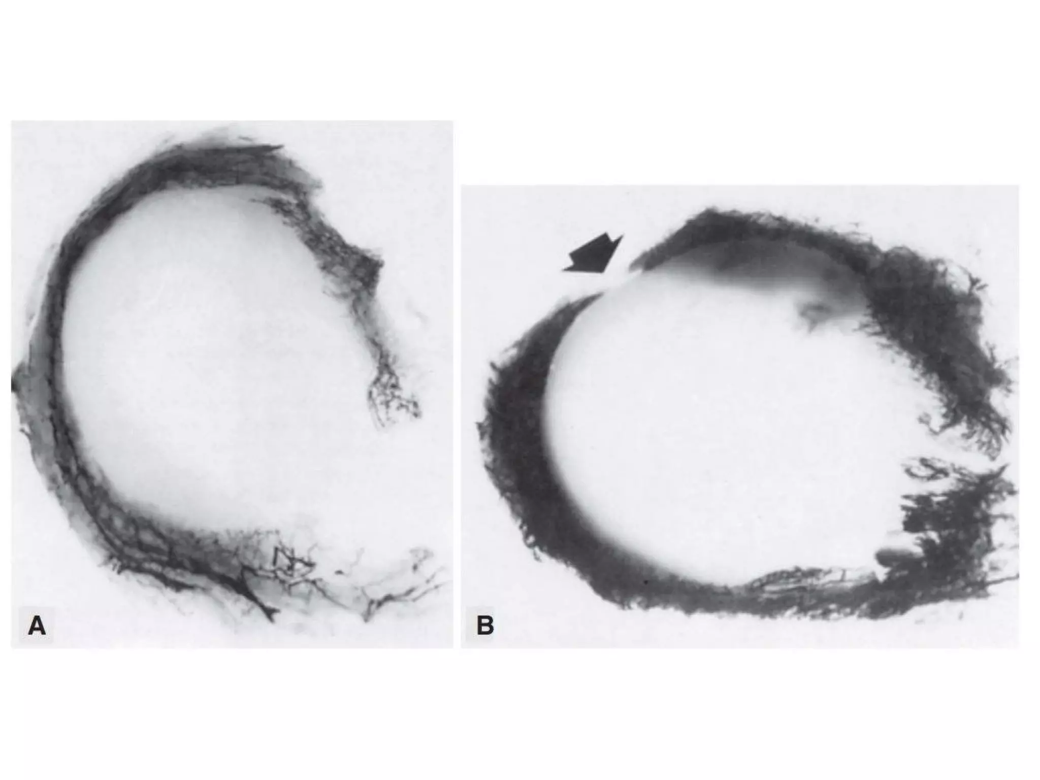Meniscus - Anatomy, function and injury | PPTX