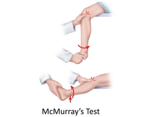 Meniscus - Anatomy, function and injury | PPTX