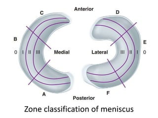 Meniscus - Anatomy, function and injury | PPTX