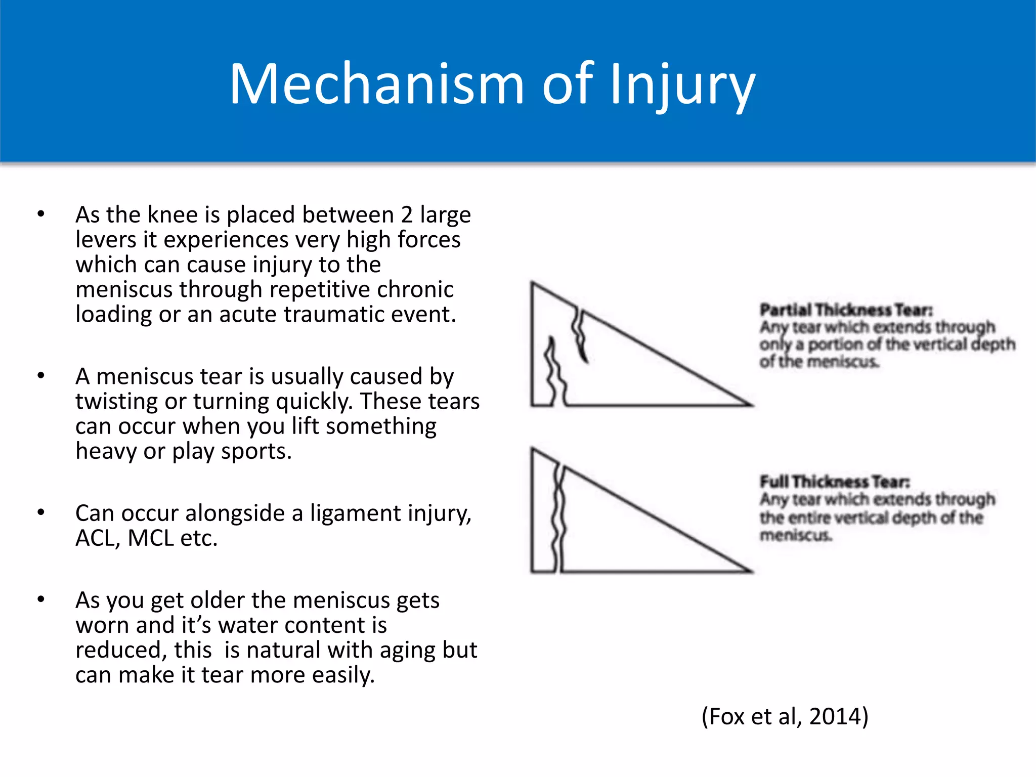 Meniscus: Structure, Role & Injury. | PPTX