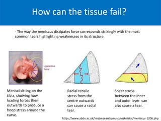 Meniscus: Structure, Role & Injury. | PPTX
