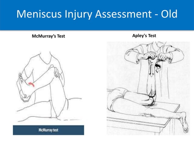 Meniscus: Structure, Role & Injury. | PPTX | Death, Injury, or Military ...