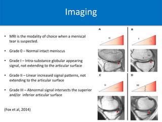 Meniscus: Structure, Role & Injury. | PPTX