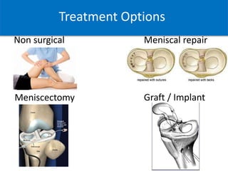 Meniscus: Structure, Role & Injury. | PPTX