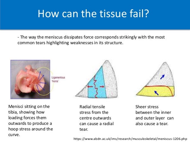Meniscus: Structure, Role & Injury.