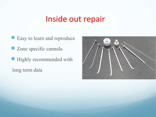 MENISCUS REPAIR I Dr.RAJAT JANGIR JAIPUR | PPT