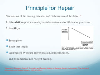 MENISCUS REPAIR I Dr.RAJAT JANGIR JAIPUR | PPT