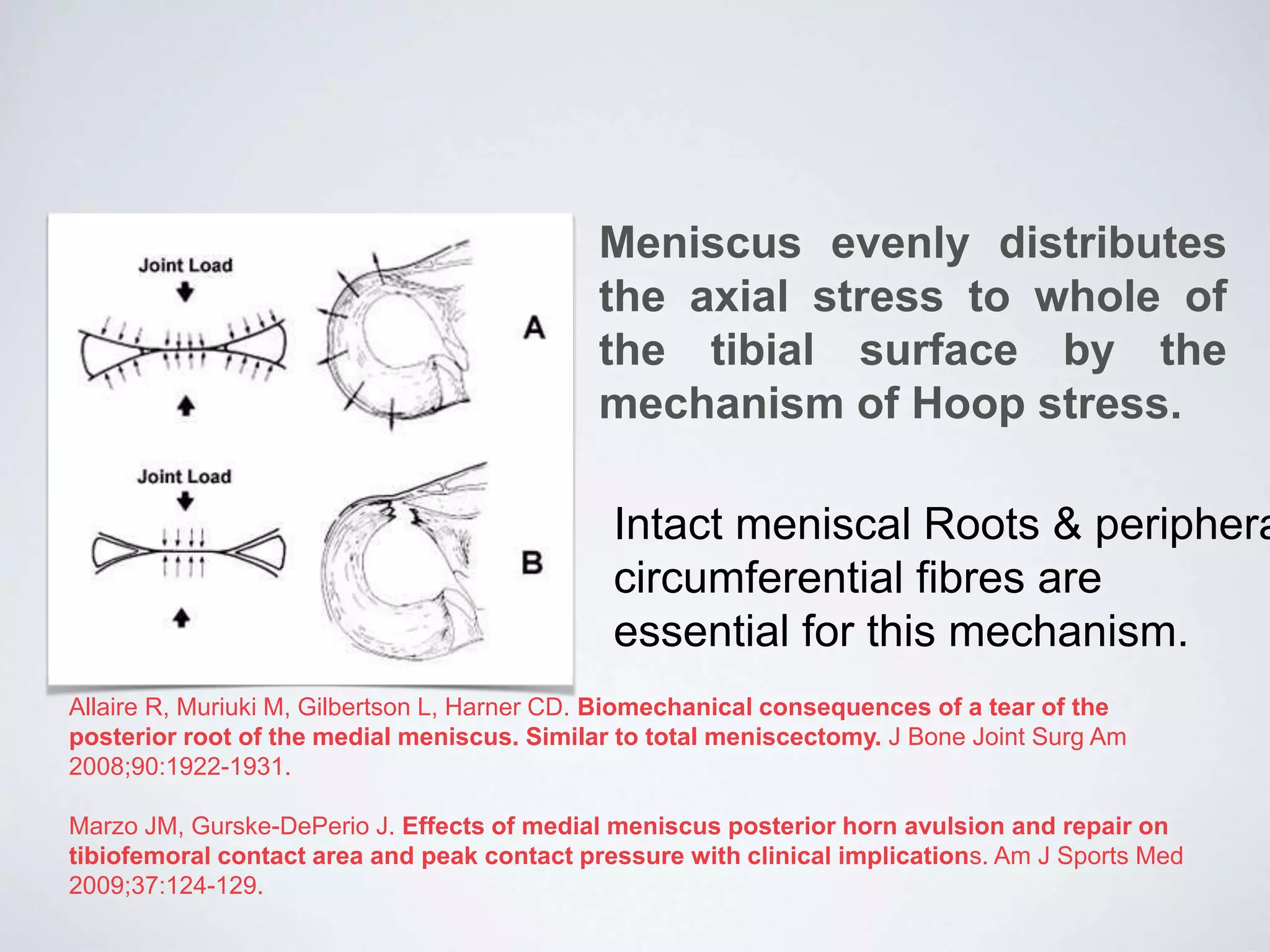 Meniscus repair Indication & Techniques.ppt