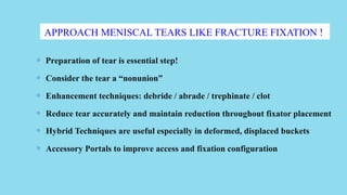 Meniscus repair surgery in Jaipur - Dr.Rajat Jangir | PPT