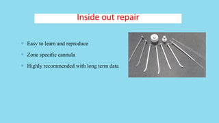 Meniscus repair surgery in Jaipur - Dr.Rajat Jangir | PPT