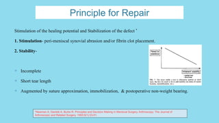Meniscus repair surgery in Jaipur - Dr.Rajat Jangir | PDF