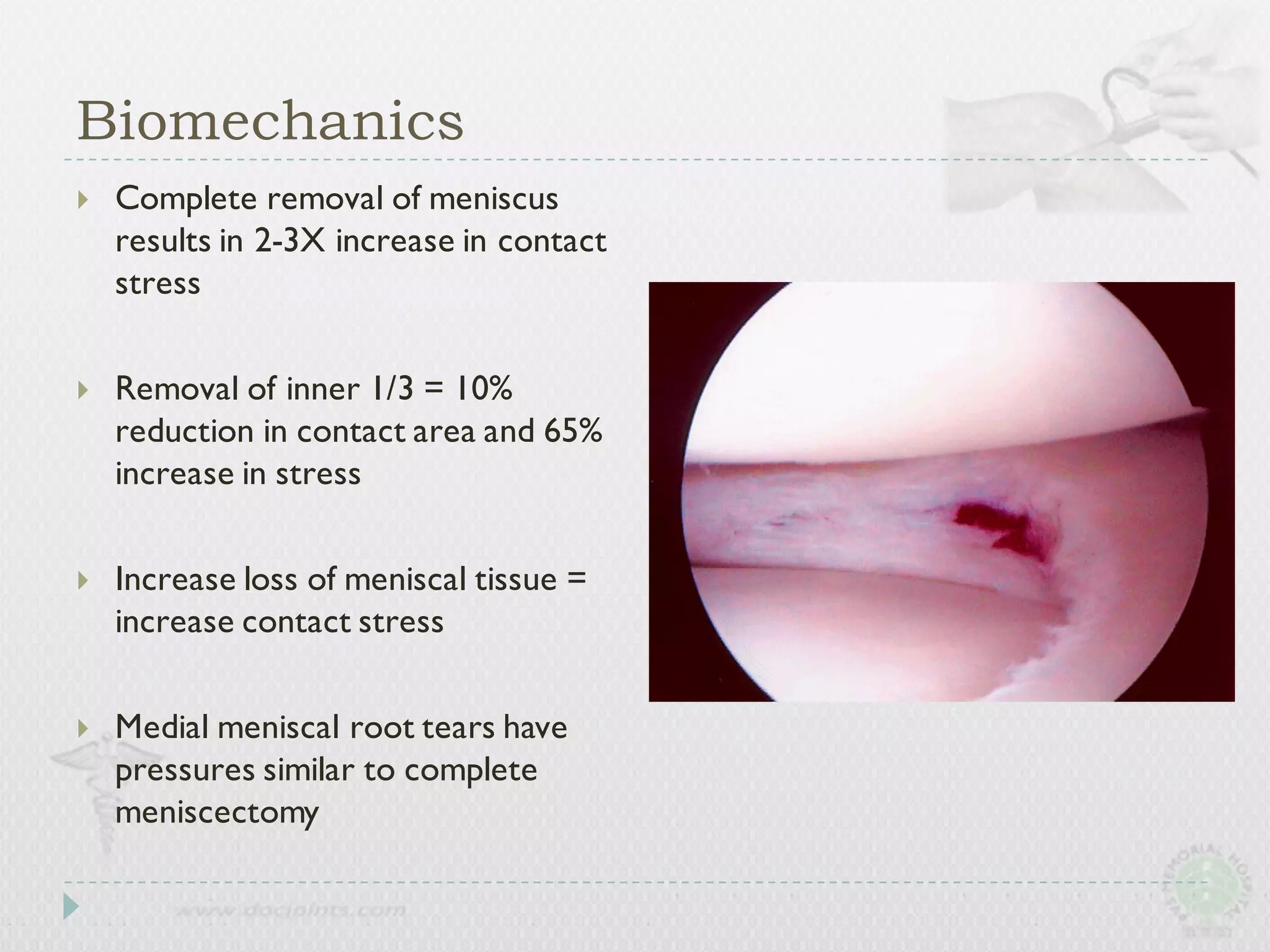 Meniscus repair vs meniscectomy | PDF