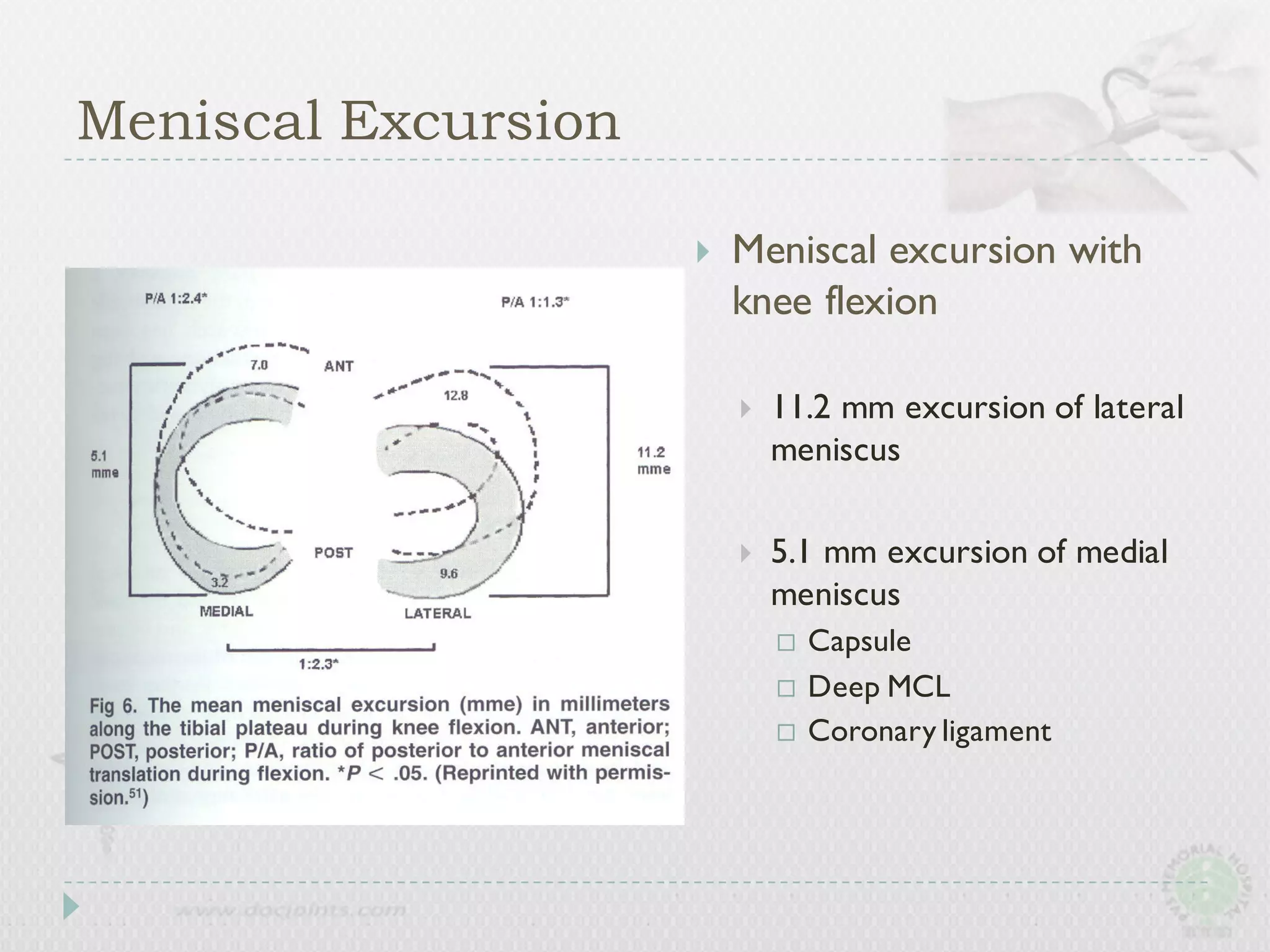 Meniscus repair vs meniscectomy | PDF