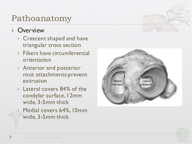 Meniscus Repair Vs Meniscectomy