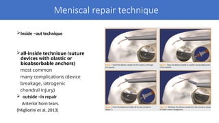 Meniscus, role, treatment. dr. Haki Selaj.pptx | Death, Injury, or ...