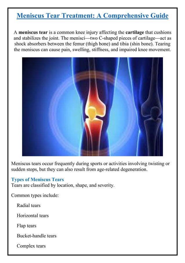 Meniscus Tear Treatment: A Comprehensive Guide | PDF
