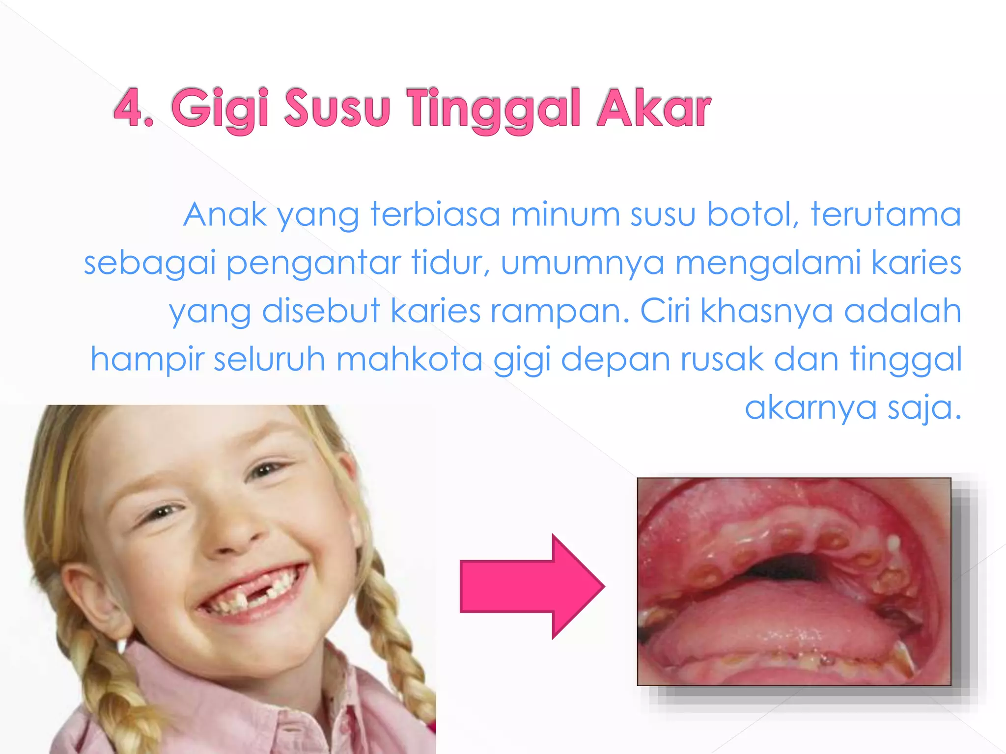 Menjaga Kesehatan Gigi dan Mulut pada Anak | PPTX