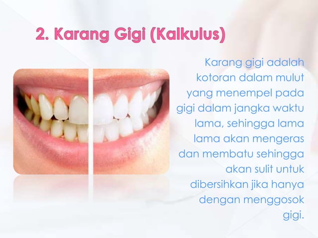Menjaga Kesehatan Gigi dan Mulut pada Anak | PPTX