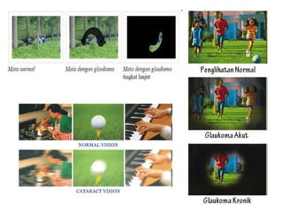 Menjaga kesehatan mata | PPT